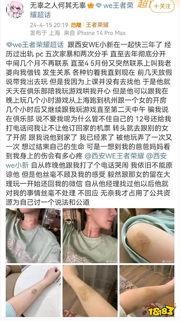 下一个劲夫！WE小新女友发文控诉小新家暴出轨？_18183.com